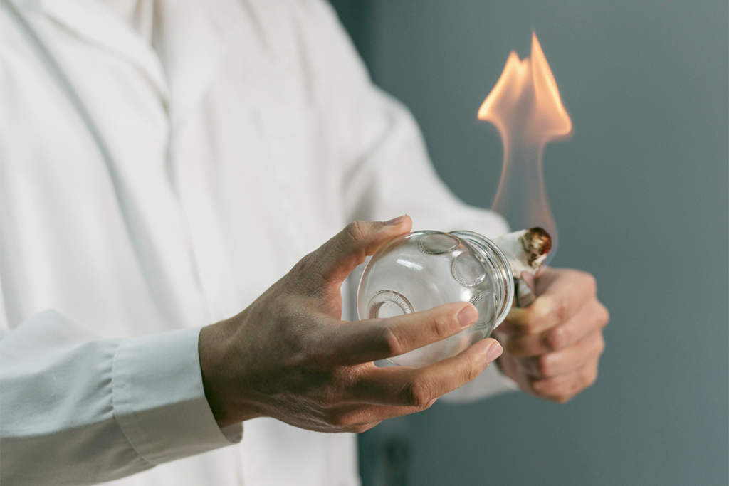 Cupping in Jumeirah Therapy | Water Spa Dubai